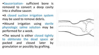 Osteomyelitis and its management | PPTX