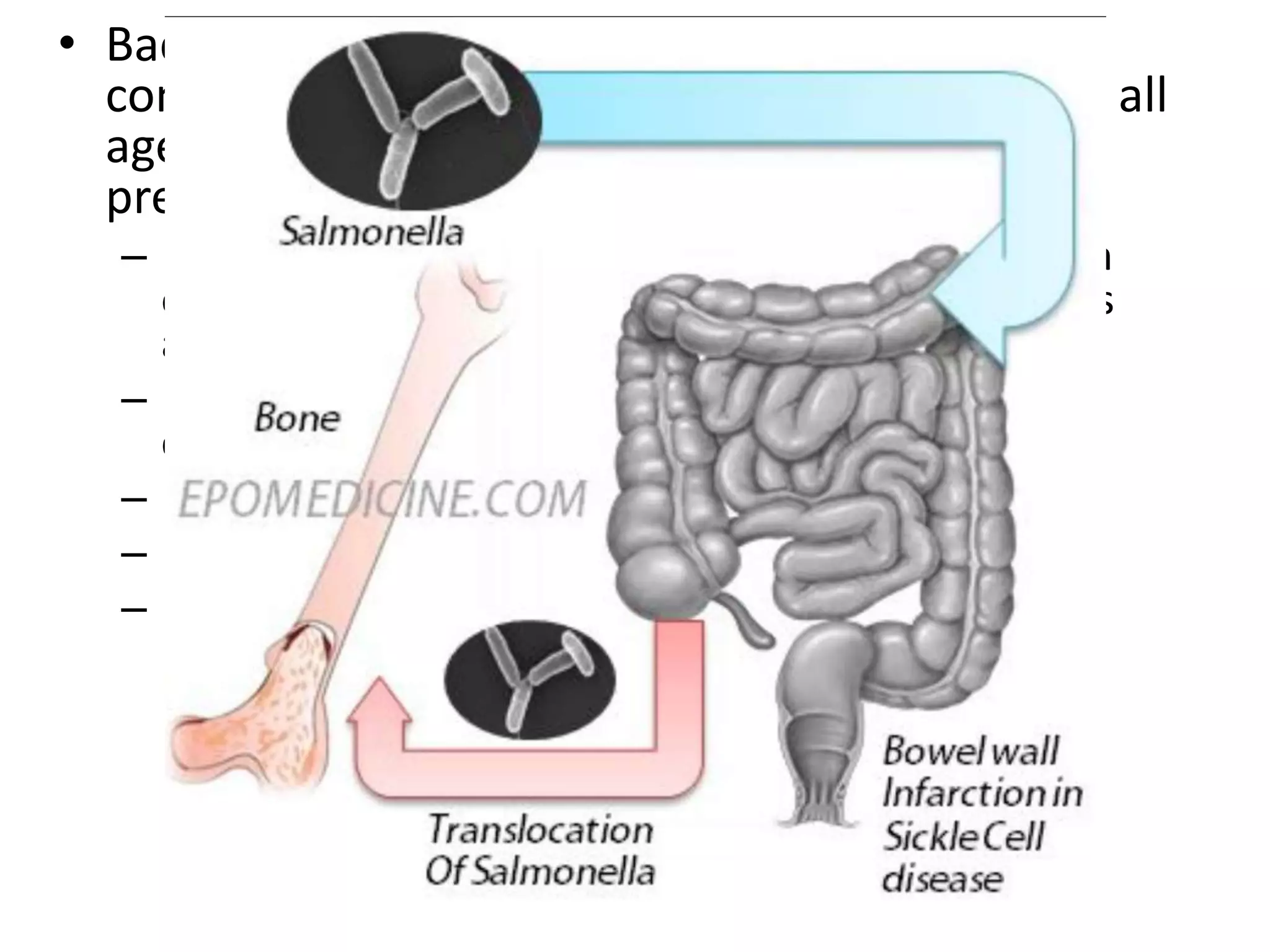 Osteomyelitis | PPTX