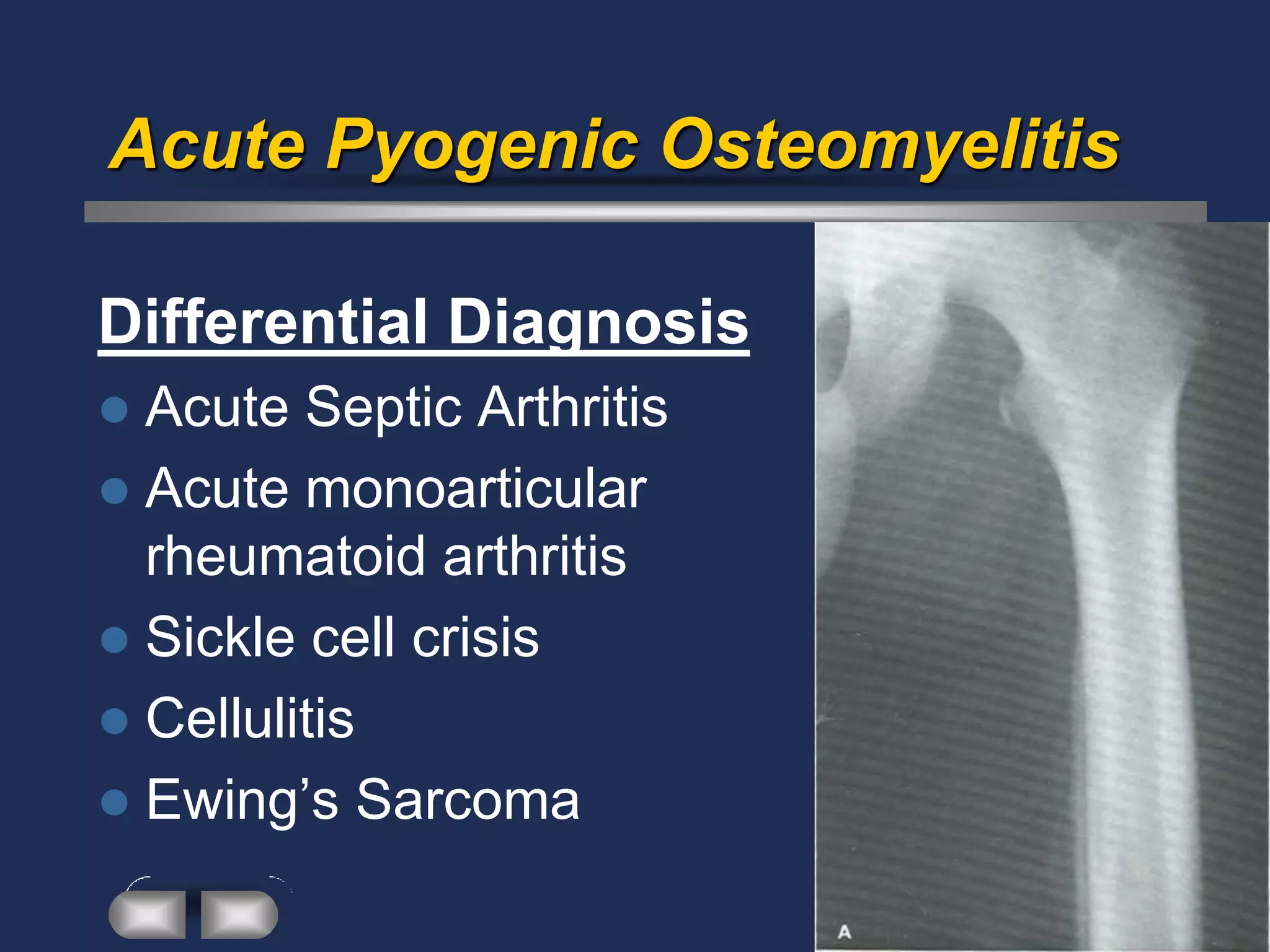 osteomyelitis.pptx
