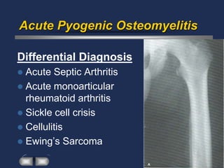 osteomyelitis.pptx