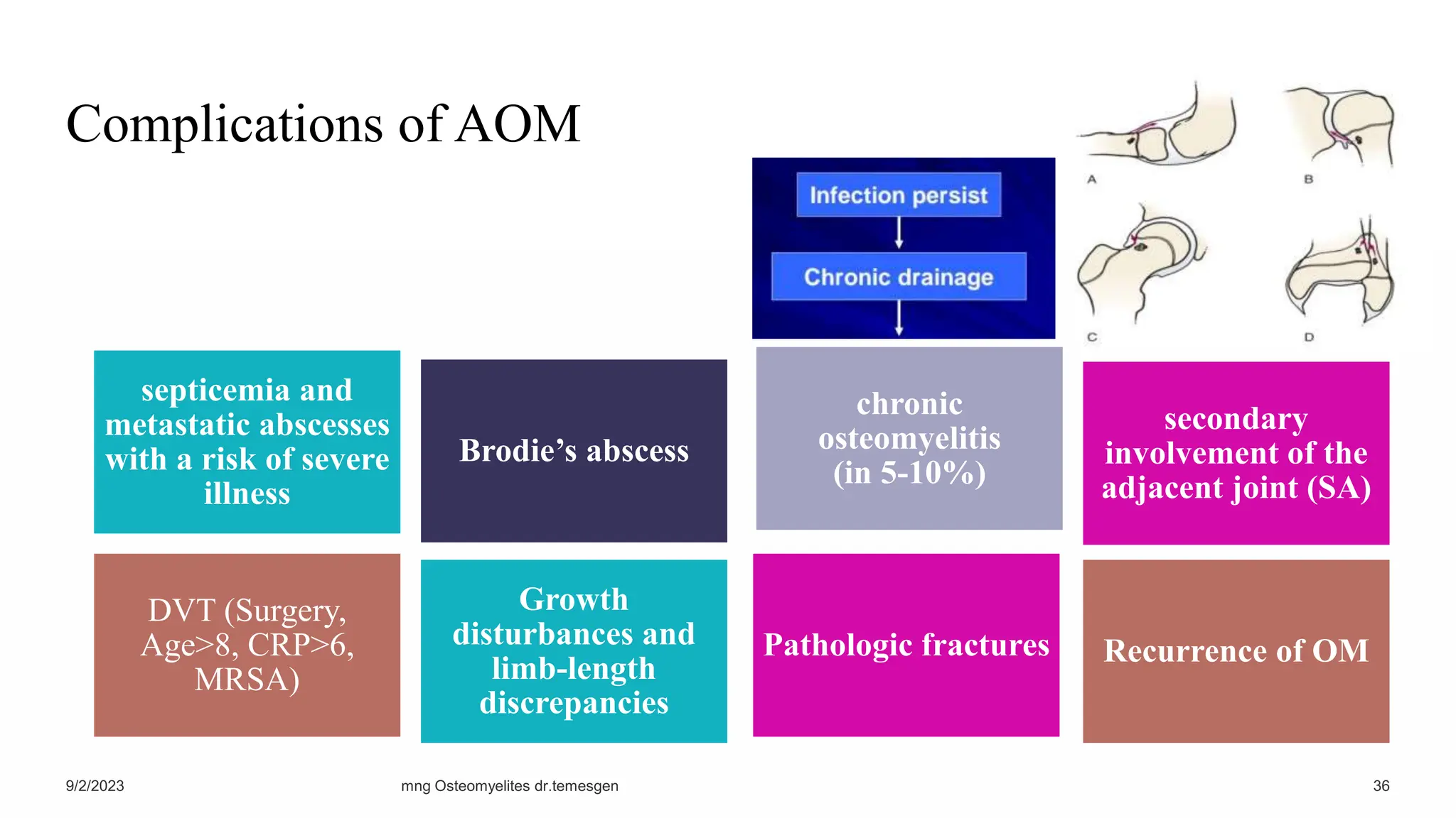 OSTEOMYELITIS .pptx