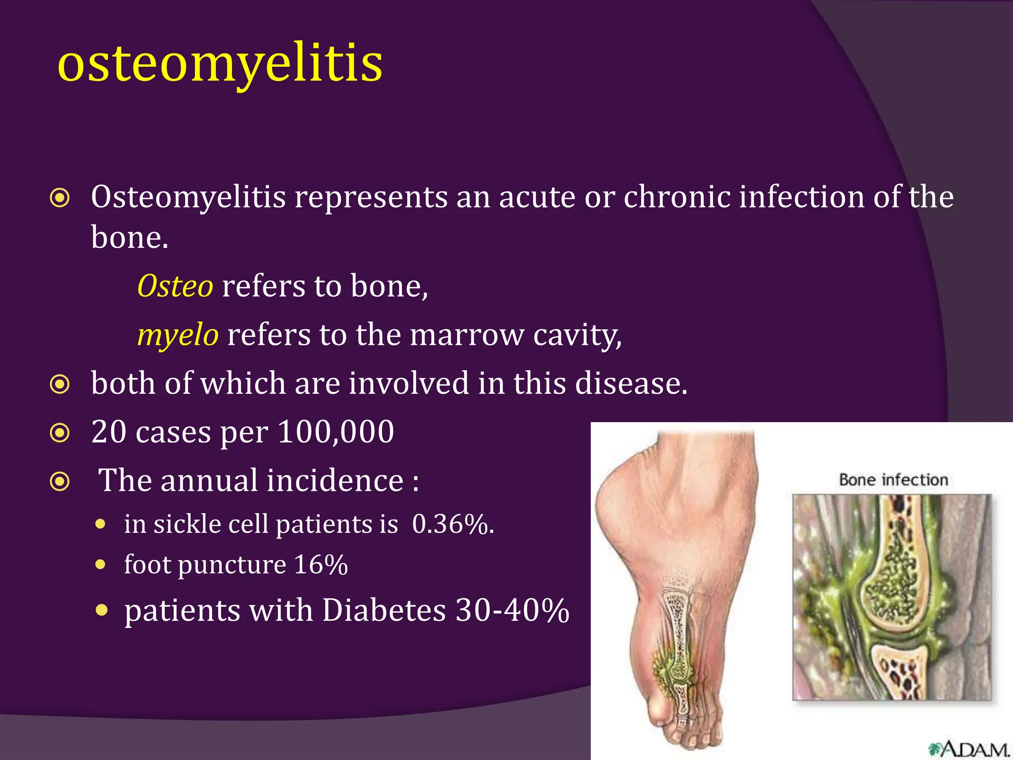 osteomyelitis.ppt