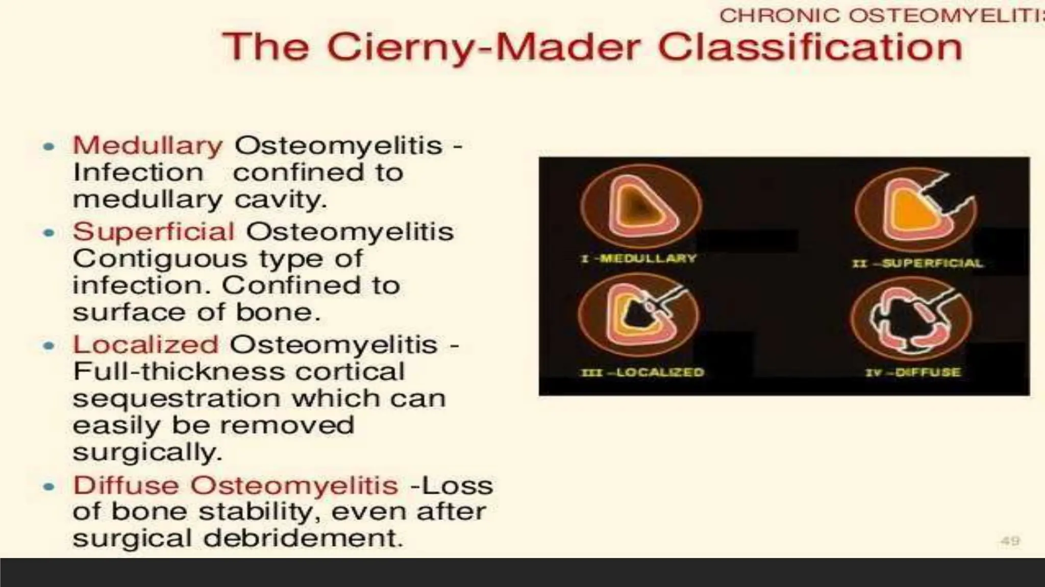Chronic Osteomyelitis, Bone infection slides | PPTX