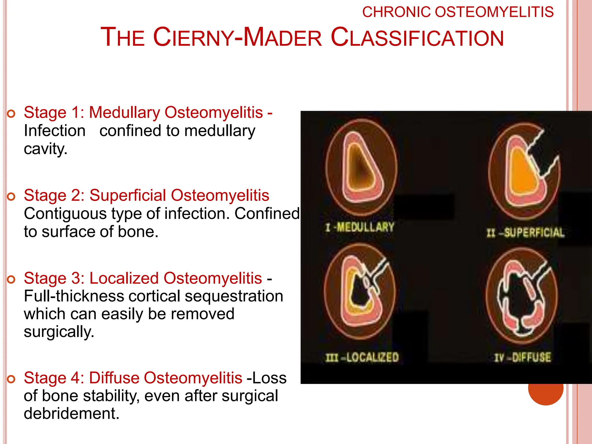 ppt class note onOsteomyelitis.ppt orthopedicsx | PPTX | Bone and Joint ...