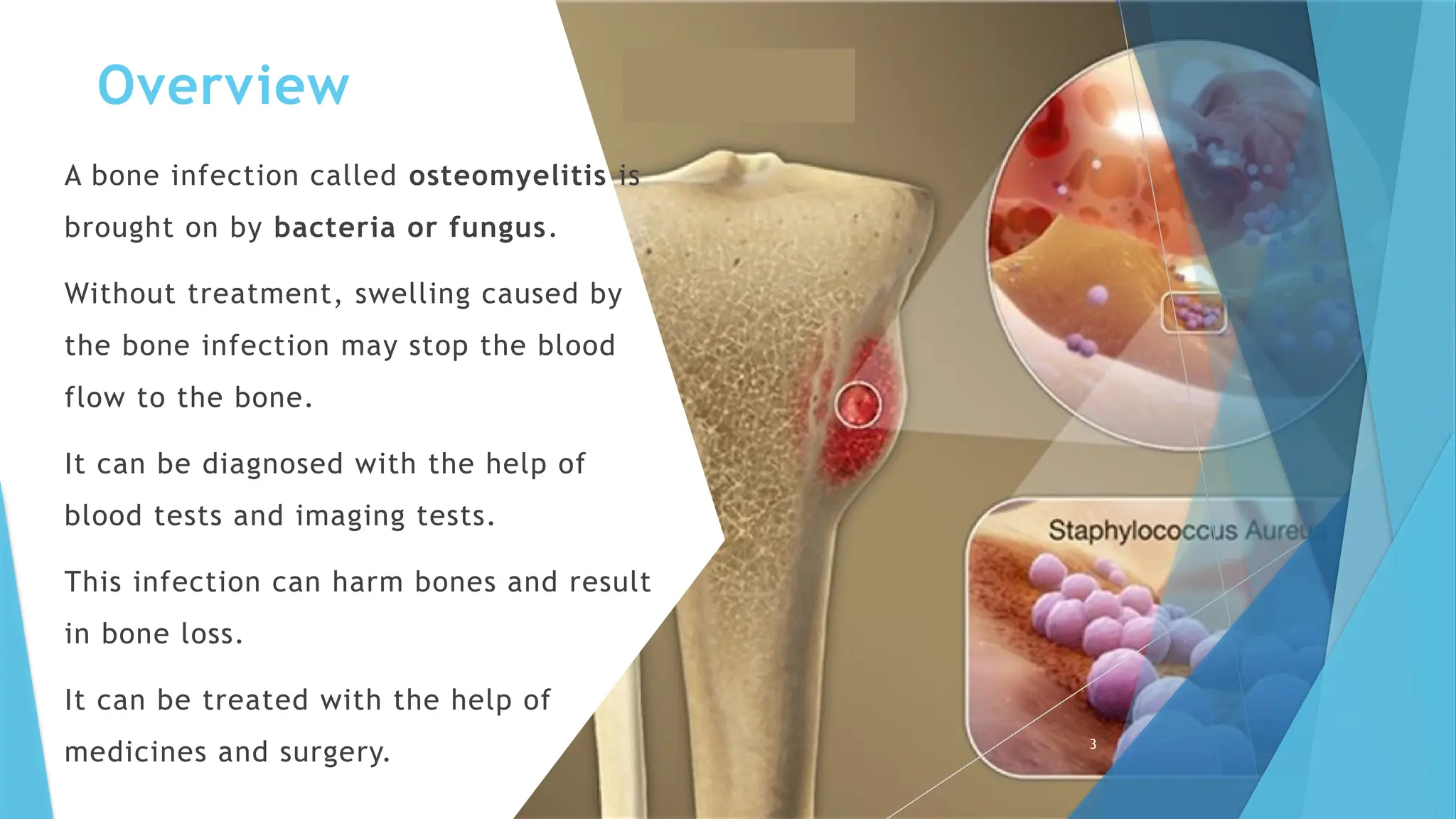 Osteomyelitis.university.presentation.pptx
