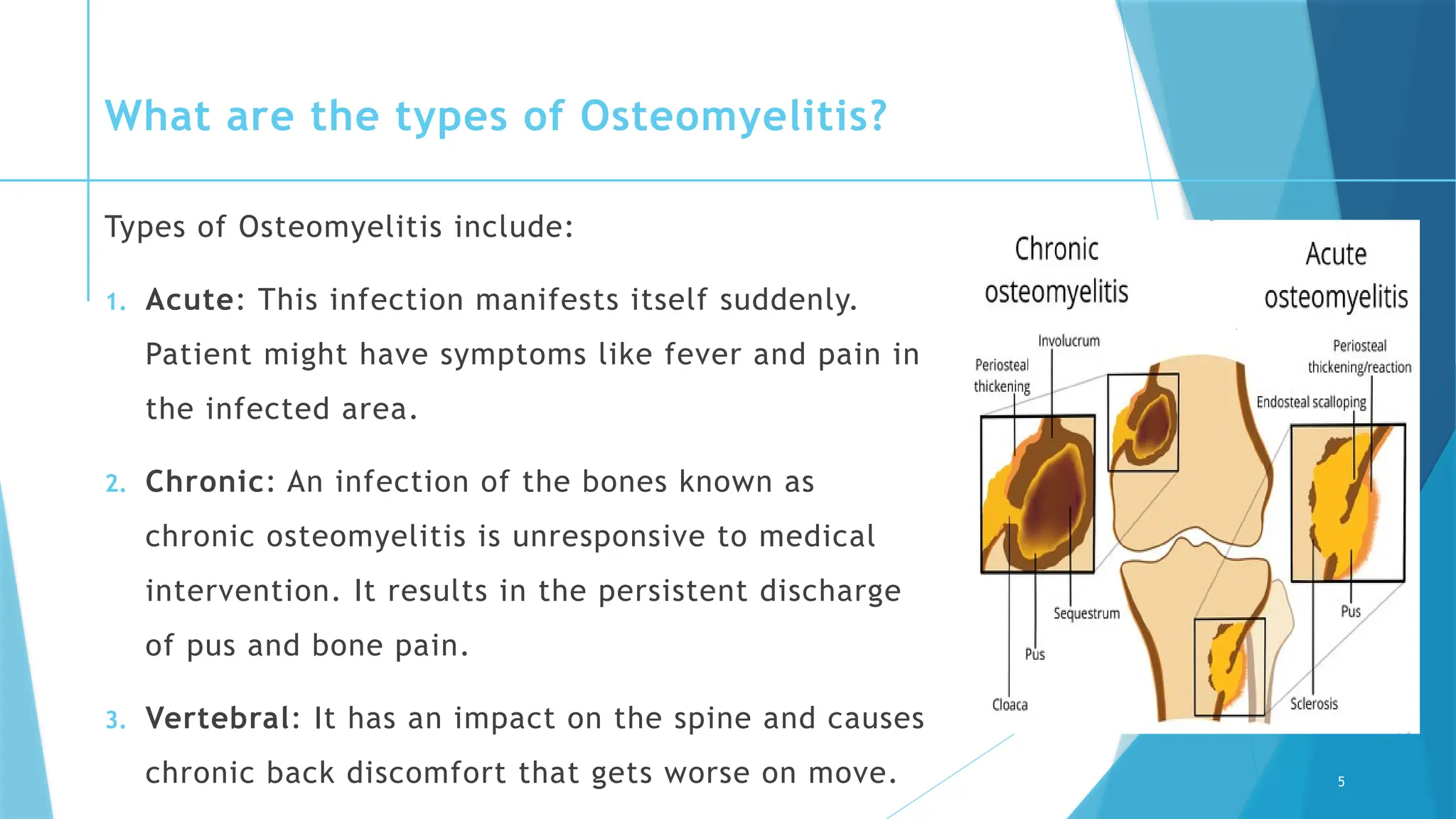 Osteomyelitis.university.presentation.pptx