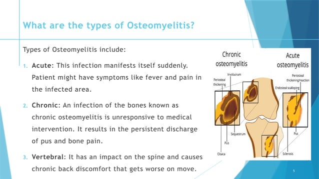 Osteomyelitis.university.presentation.pptx
