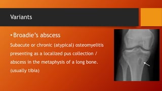 Osteomyelitis (Nutshell) | PPTX