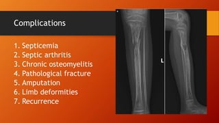 Osteomyelitis (Nutshell) | PPTX | Bone and Joint Conditions | Diseases and Conditions