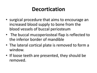 Osteomyelitis pp | PPT