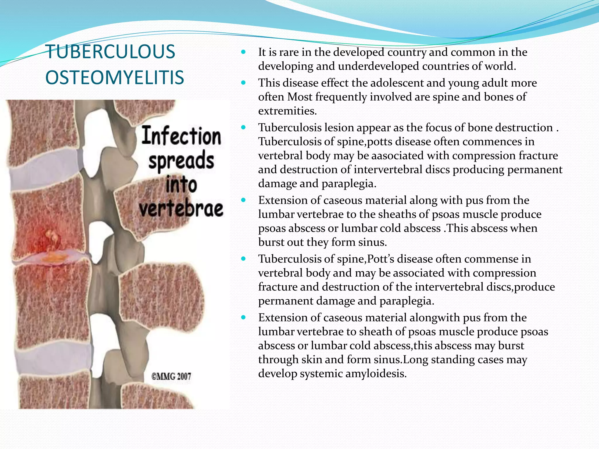 Osteomyelitis | PPTX