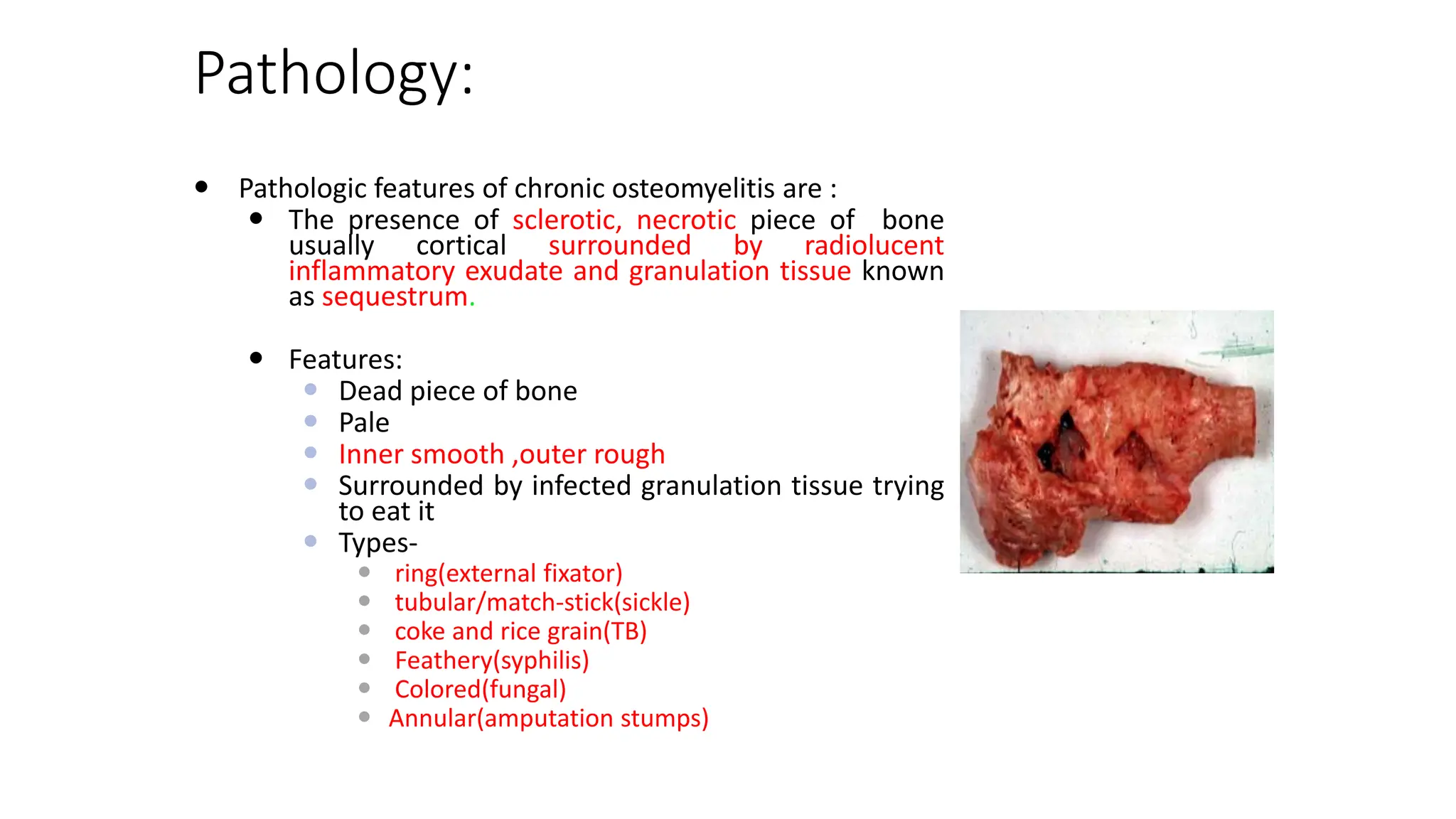 Osteomyelitis ppt for healthcare students | PPTX