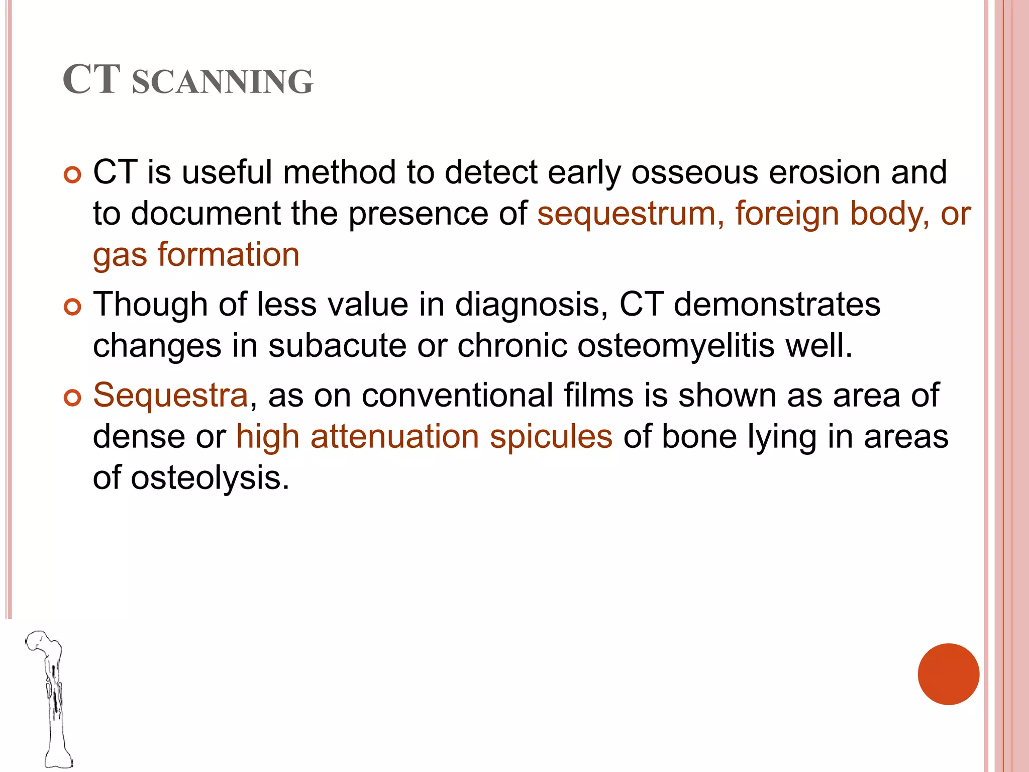 Osteomyelitis | PPTX