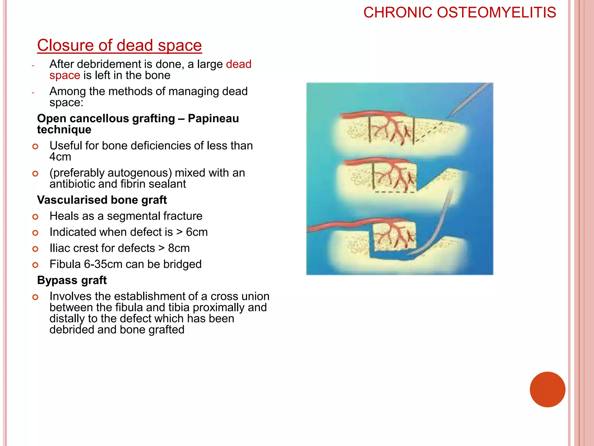 Osteomyelitis | PPTX