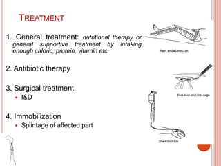 Osteomyelitis | PPTX