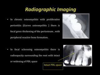 Osteomyelitis Jaw Radiographic Appearance