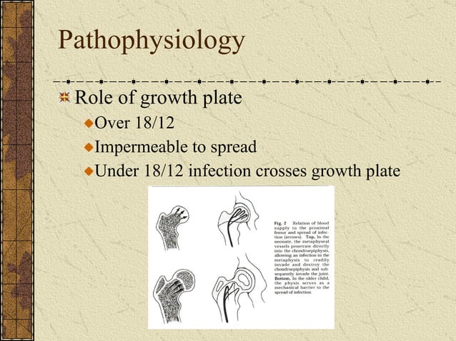 Osteomyelitis+in+Children | PPT | Bone and Joint Conditions | Diseases ...