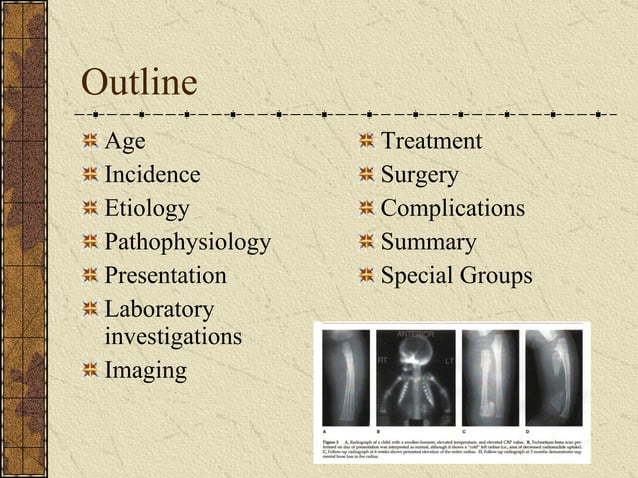 Osteomyelitis+in+Children | PPT | Bone and Joint Conditions | Diseases ...