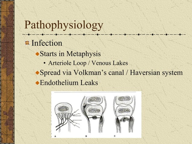 Osteomyelitis+in+Children | PPT | Bone and Joint Conditions | Diseases ...
