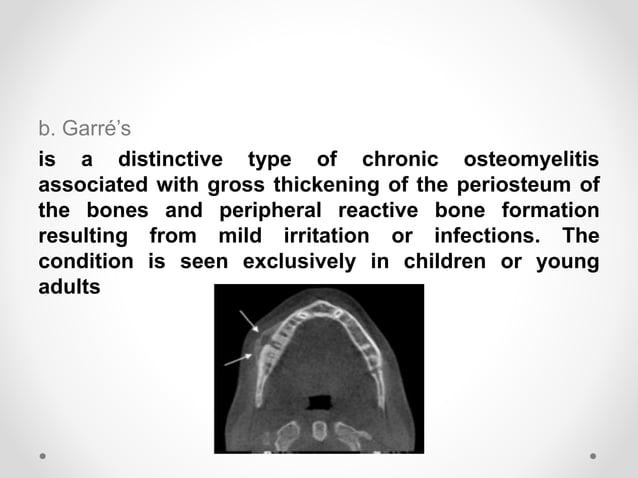 Osteomyelitis_Inflammatory_bone_Diseases_ppt ...