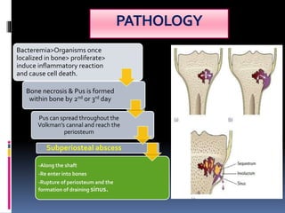 Osteomyelitis & its management | PPT