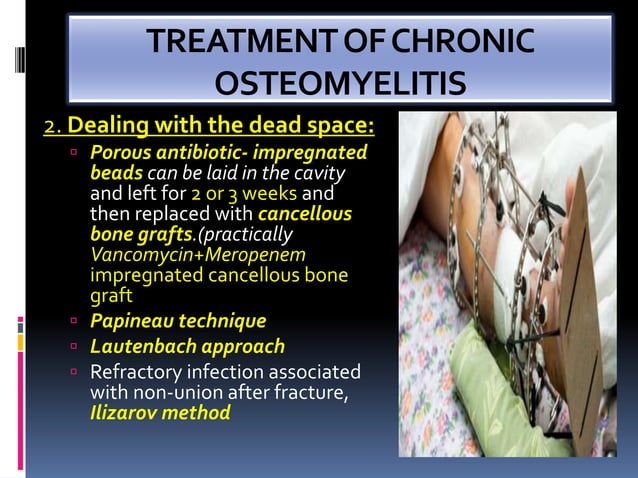 Osteomyelitis & its management | PPTX