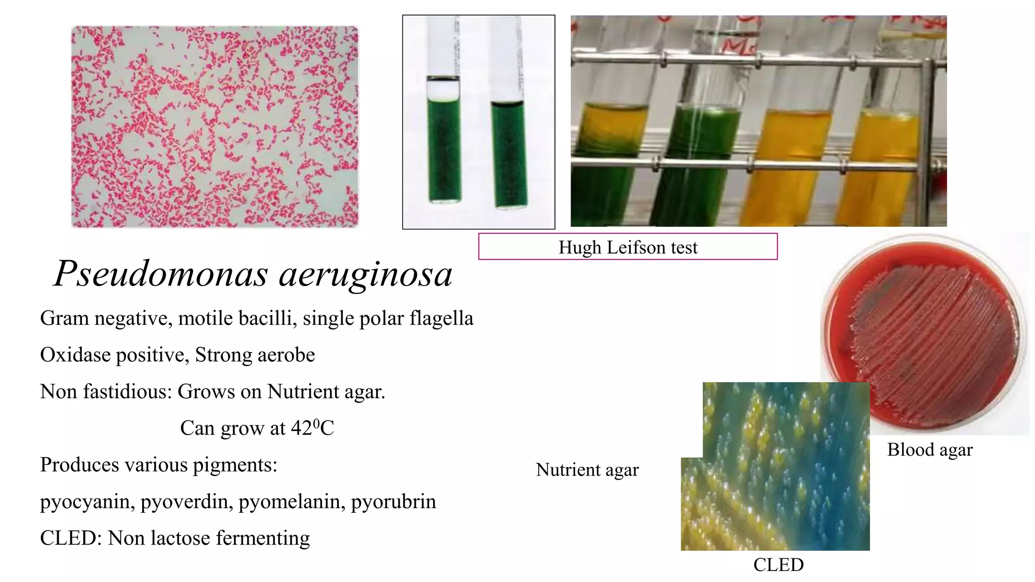 Osteomyelitis march 2018 | PPTX