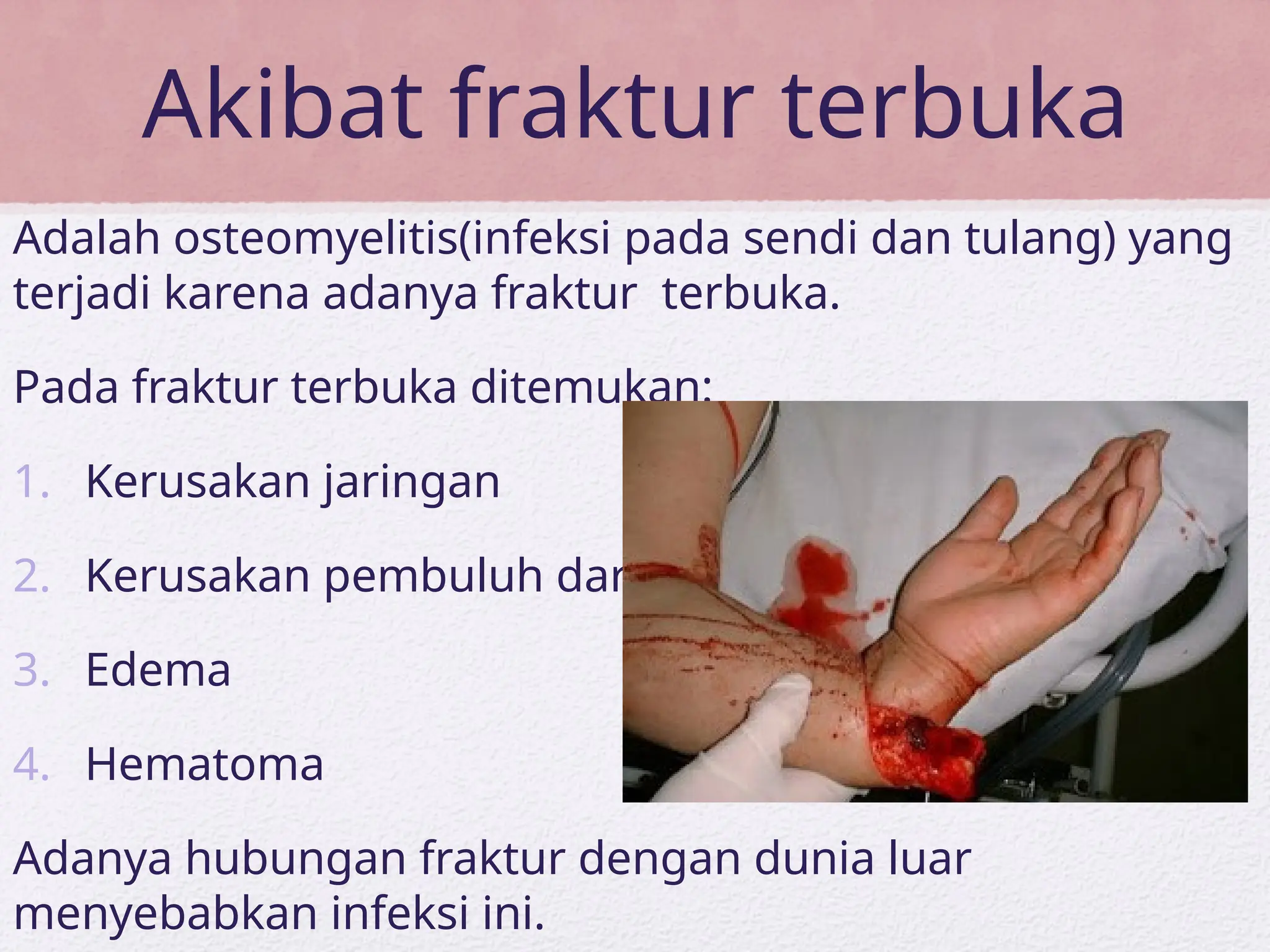 Osteomyelitis ( infeksi peradangan pada tulang ) | PPTX