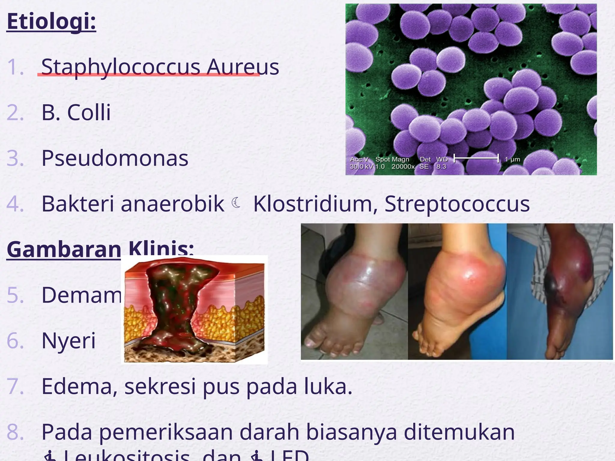 Osteomyelitis ( infeksi peradangan pada tulang ) | PPTX