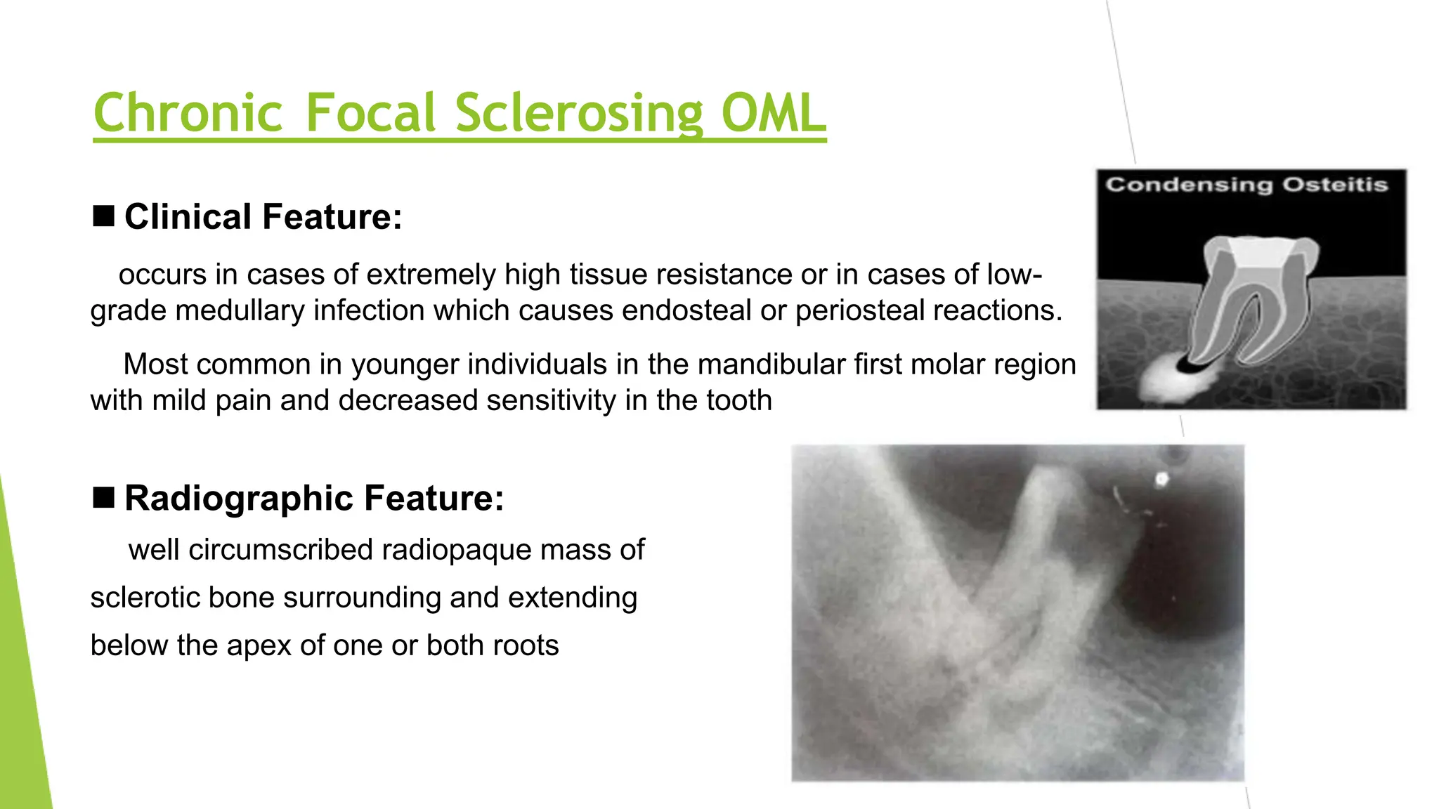 Osteomyelitis with Types and Treatment.. | PPTX