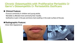 Osteomyelitis with Types and Treatment.. | PPTX