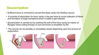 Osteomyelitis with Types and Treatment.. | PPTX