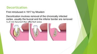 Osteomyelitis with Types and Treatment.. | PPTX