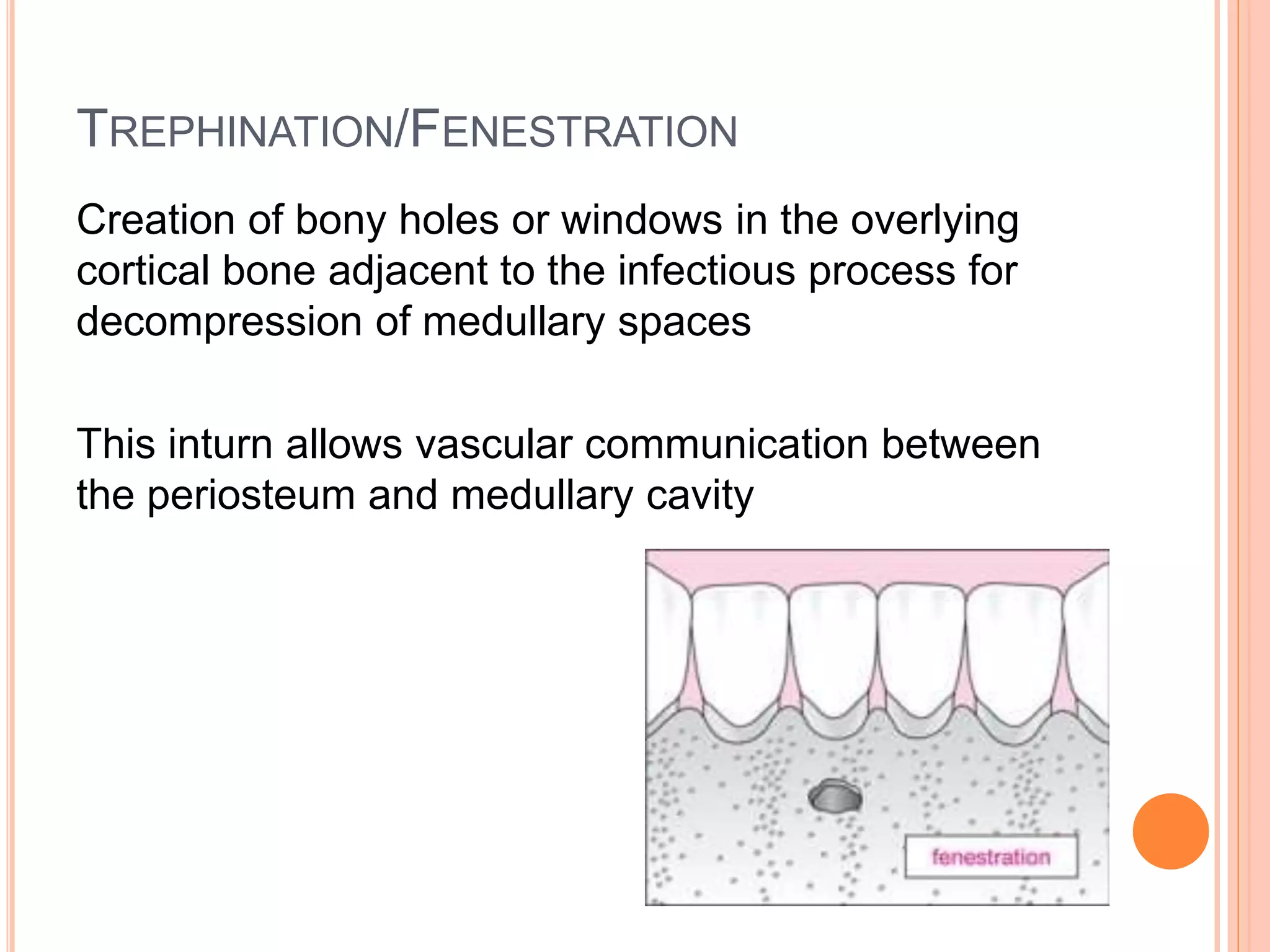 Osteomyelitis of jaws dikiohs | PPTX