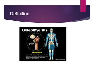 Osteomyelitis ppt | PPTX