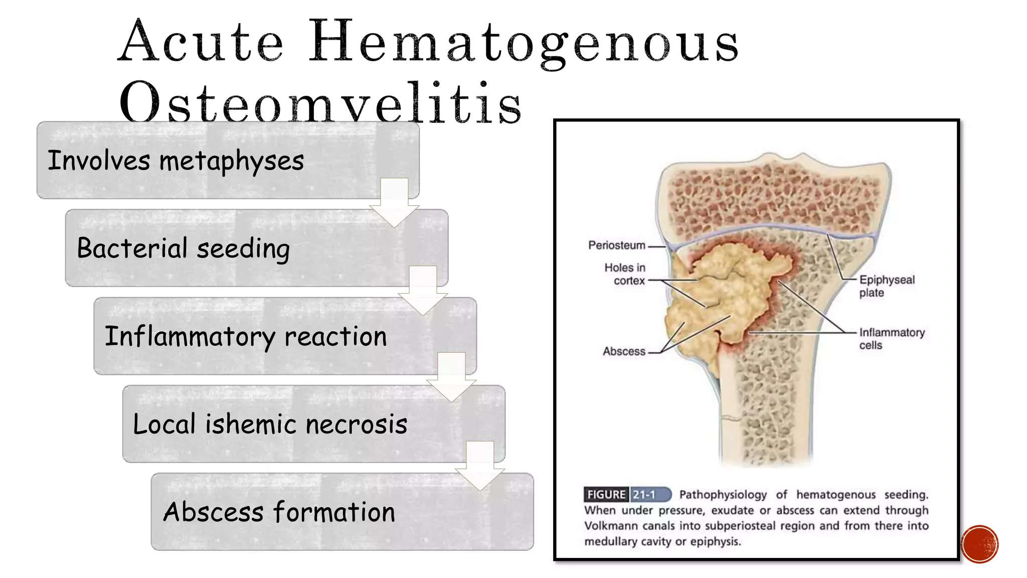 Osteomyelitis ppt | PPT