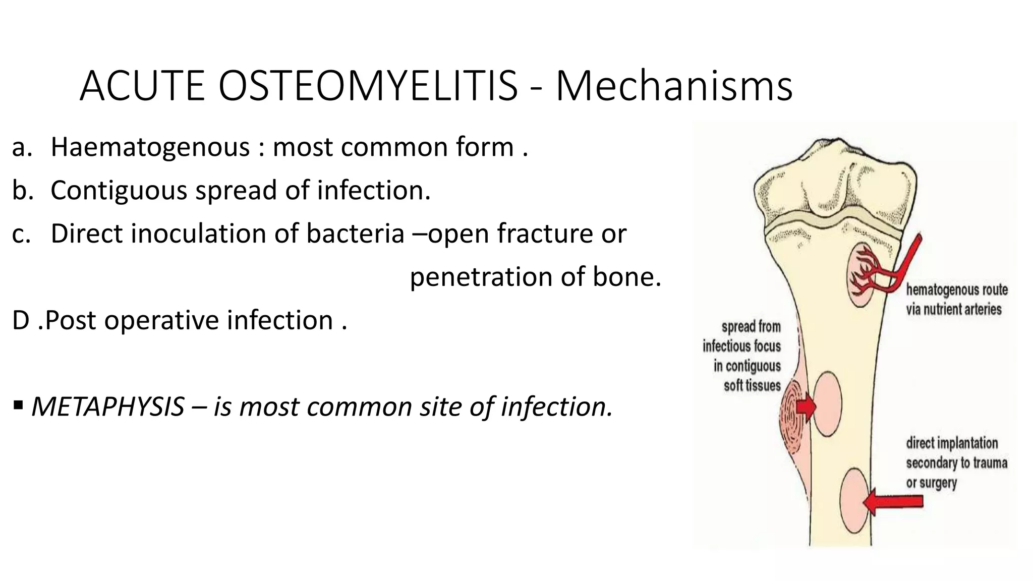 osteomyelitis ppt.pptx