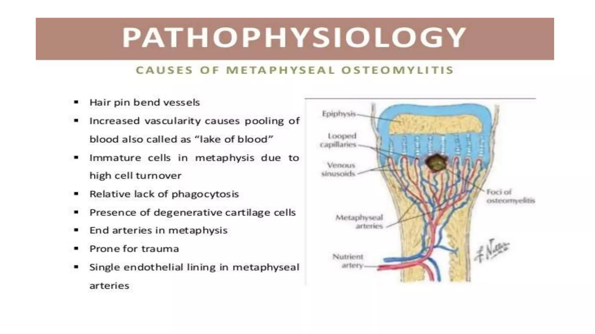 osteomyelitis ppt.pptx