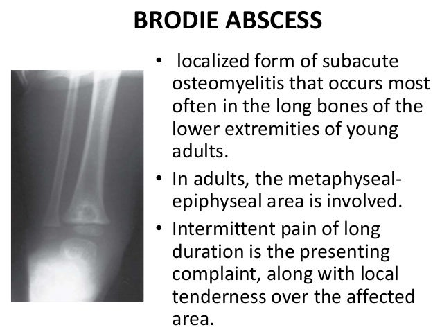 Osteomyelitis seminar