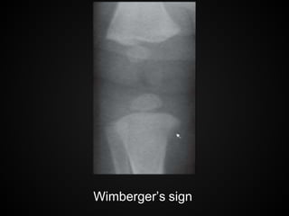 Introduction to radiological diagnosis of osteomyelitis for ...