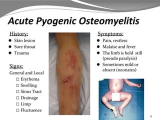 Osteomyeltis.pptx
