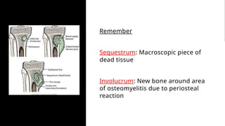 Surgical aspects of osteomyleitis. .pptx