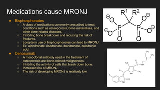 Osteonecrosis: Radiation Necrosis of the Bone | PPT