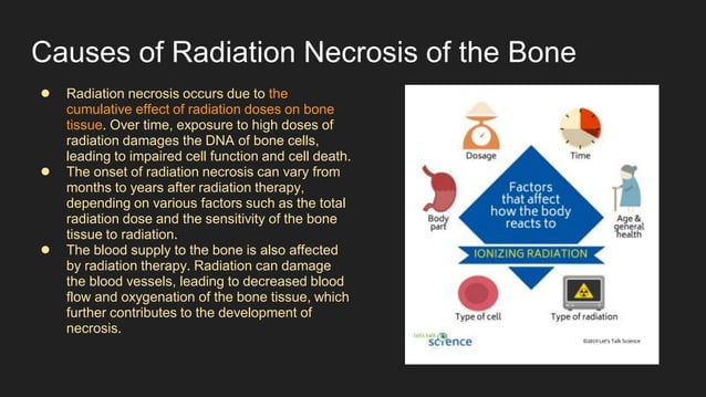Osteonecrosis: Radiation Necrosis of the Bone | PPT