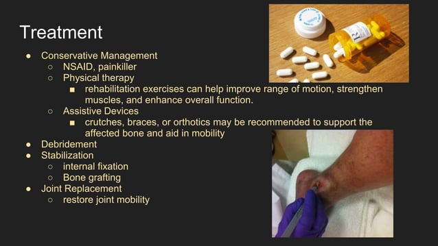 Osteonecrosis: Radiation Necrosis of the Bone | PPT