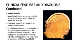 Osteonecrosis (avascular necrosis ).pptx | Bone and Joint Conditions ...