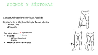 Osteonecrosis de cabeza femoral | PPTX
