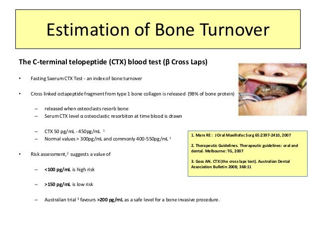 Osteonecrosis of the jaws