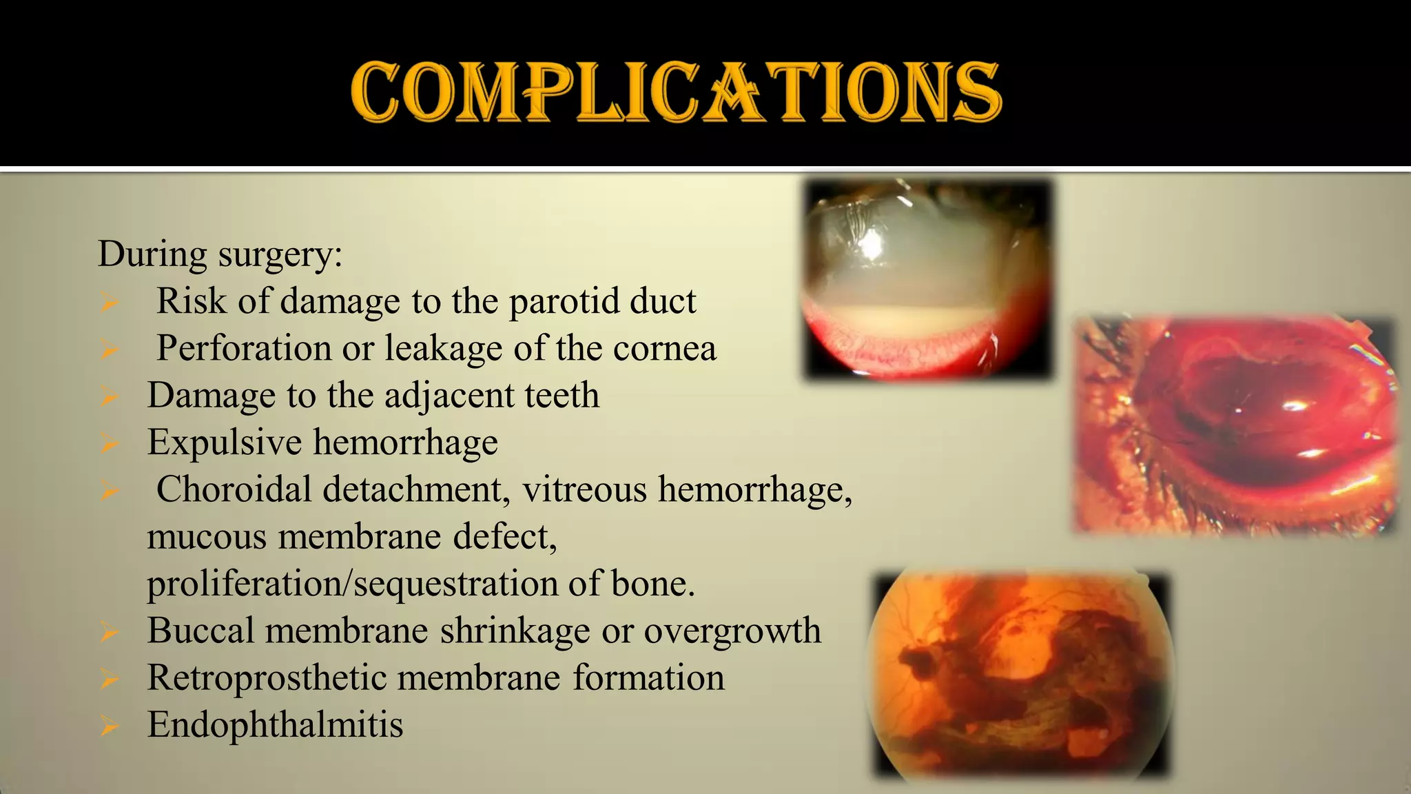 Osteo odonto kerato prosthesis | PDF