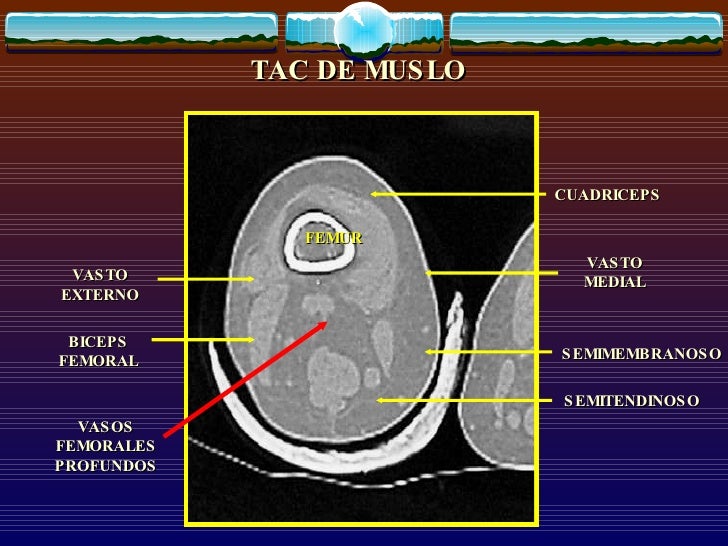OsteopatíA